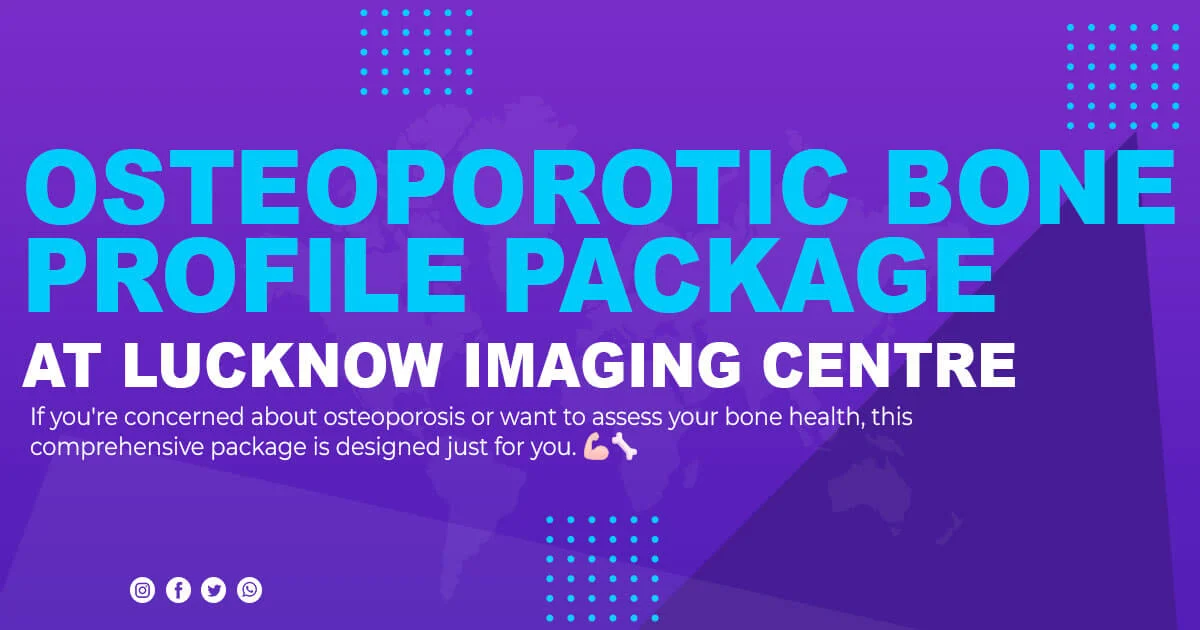 Best Osteoporotic Bone Profile Testing in Lucknow | Osteoporotic Bone ...